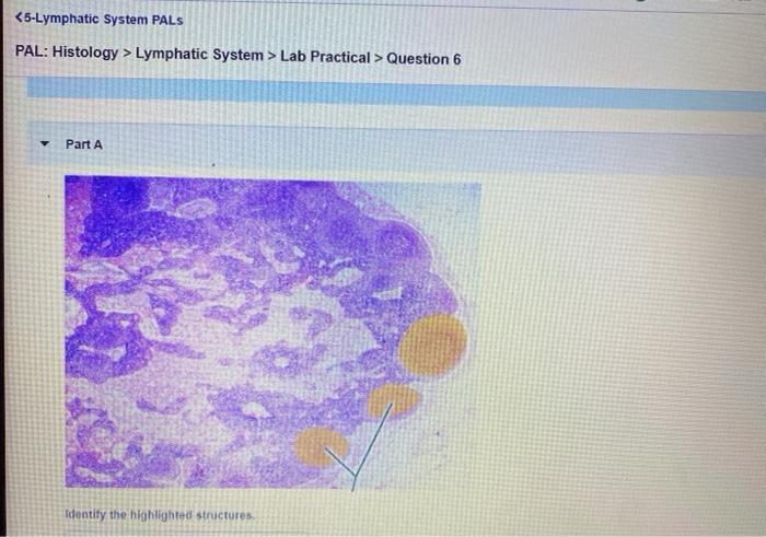 Solved Lymphatic | Chegg.com