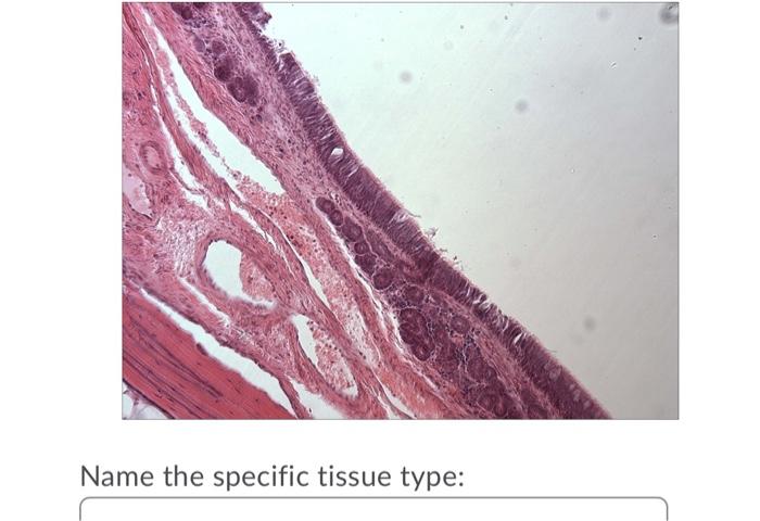 Solved 1. General tissue type: EPITHELIAL Specific tissue | Chegg.com