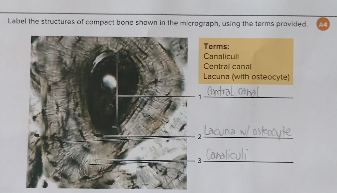 Solved Label the structures of compact bone shown in the | Chegg.com