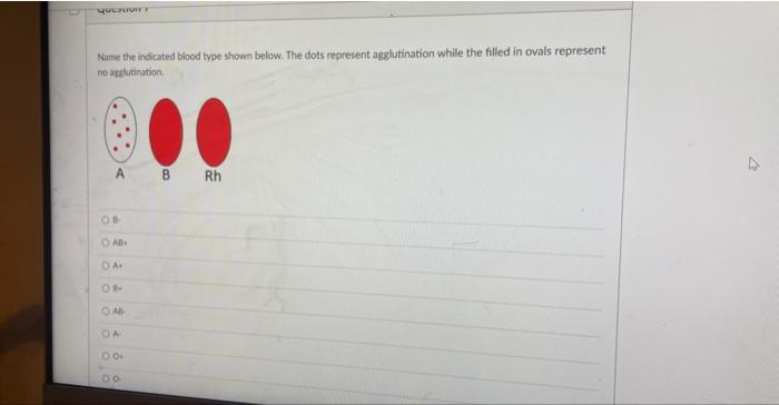 Solved QUEZOVITY Name the indicated blood type shown below. | Chegg.com