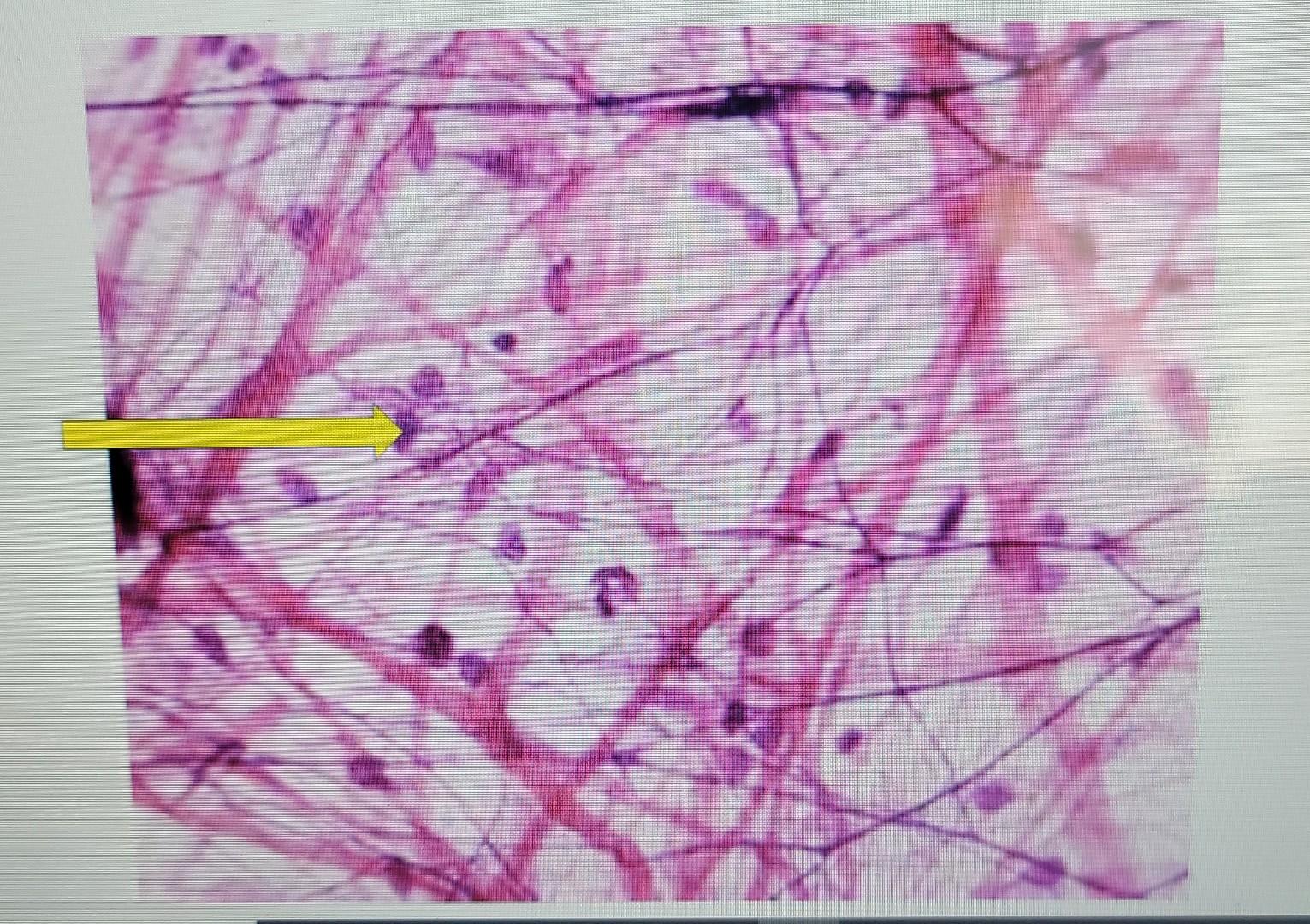 Solved sue. PRO fe regular tissue | Chegg.com