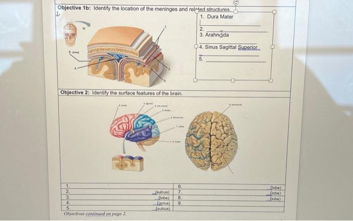 Solved Objective 1 b : Identify the location of the meninges | Chegg.com