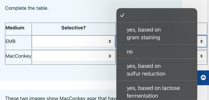 Solved Complete the table. Medium Selective? Differential? > | Chegg.com