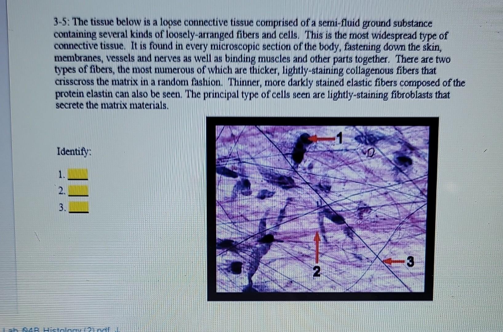 Solved 3-5: The tissue below is a loose connective tissue | Chegg.com