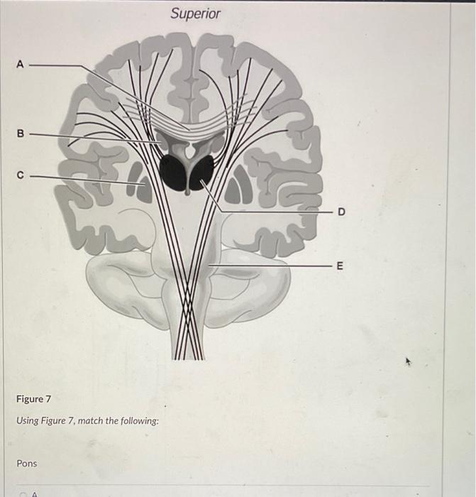 Figure 7 Using Figure 7, match the following: | Chegg.com