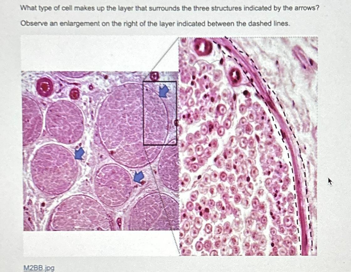 Solved What type of cell makes up the layer that surrounds | Chegg.com