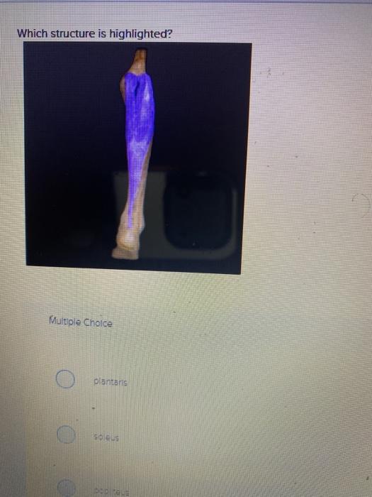 Solved Which structure is highlighted? Multiple Choice | Chegg.com