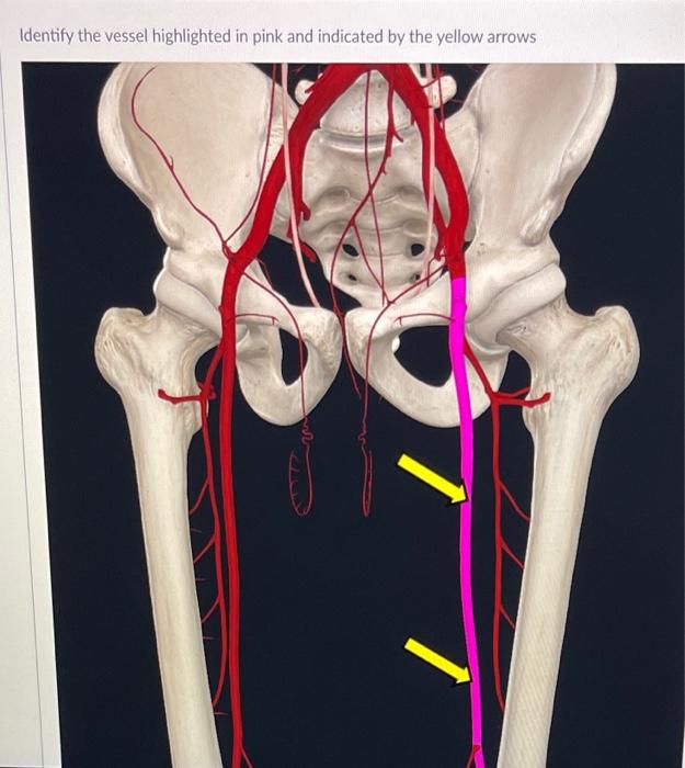 Solved Identify the vessel highlighted in pink and indicated | Chegg.com