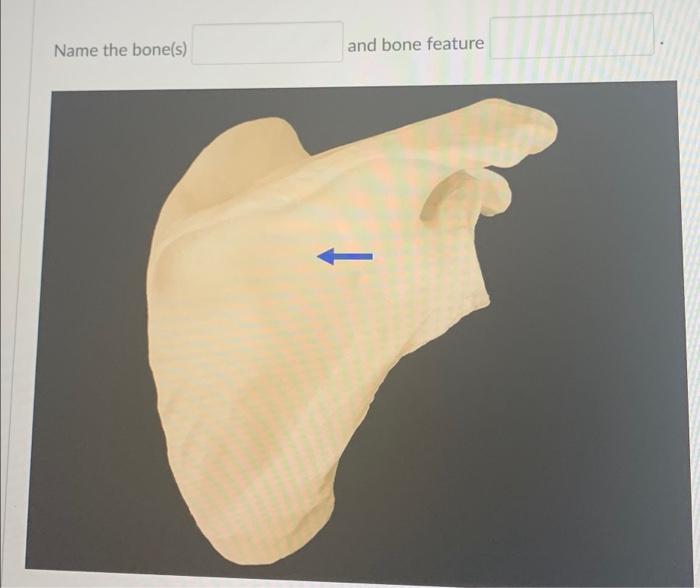 Solved Name the bone(s) and bone feature | Chegg.com