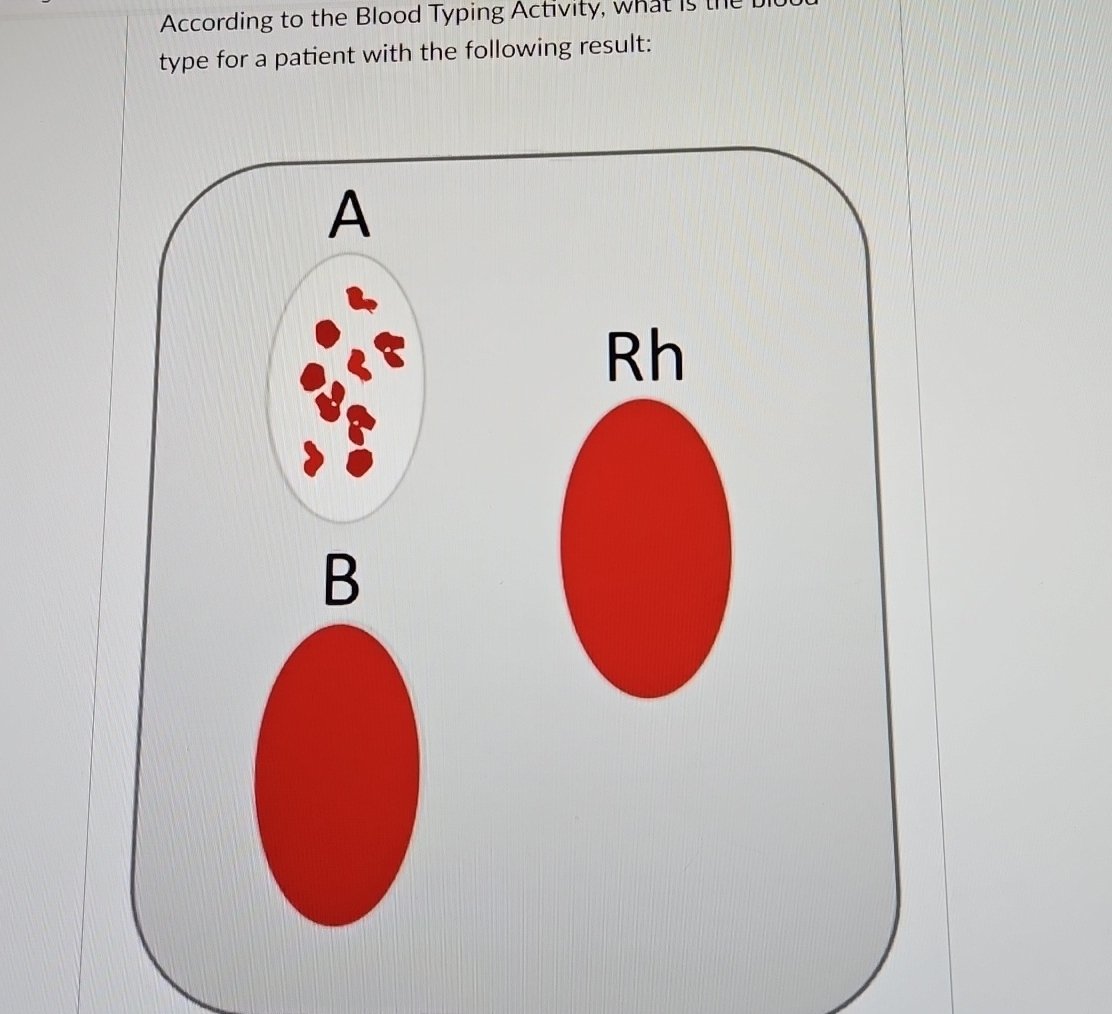 Solved According to the Blood Typing Activity, wh type for a | Chegg.com