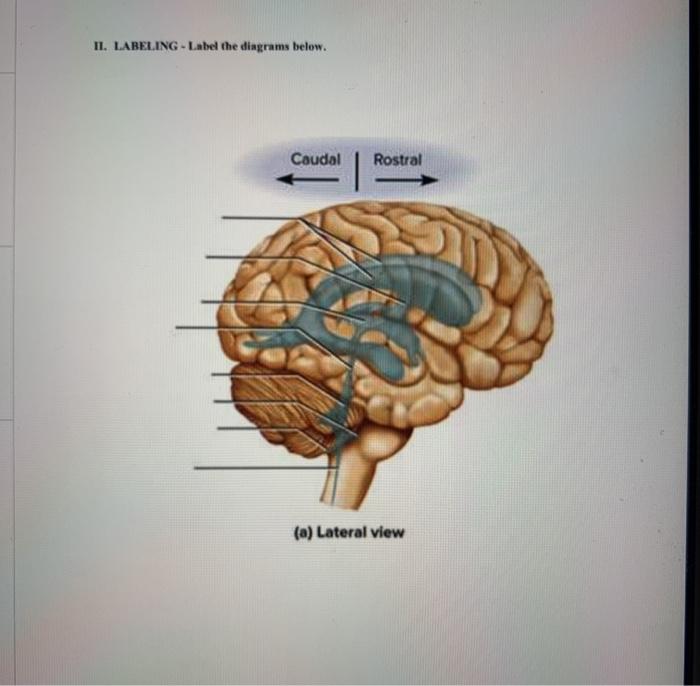 Solved II. LABELING - Label the diagrams below. Caudal | Chegg.com