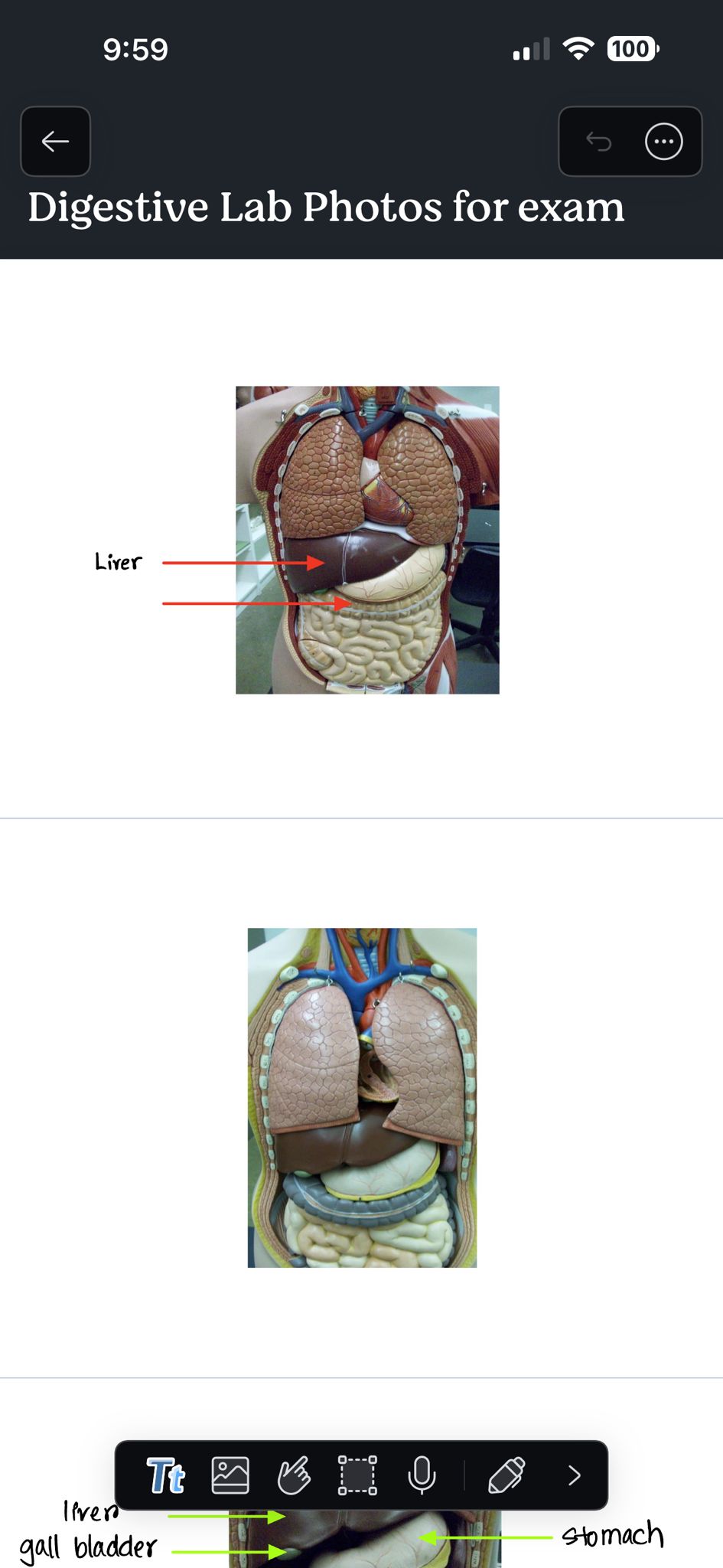 Solved Digestive Lab Photos. can someone please help me to | Chegg.com