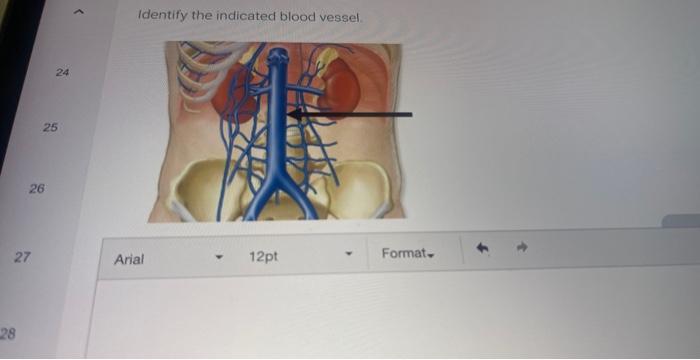 Solved Identify the indicated blood vessel. Identify the | Chegg.com