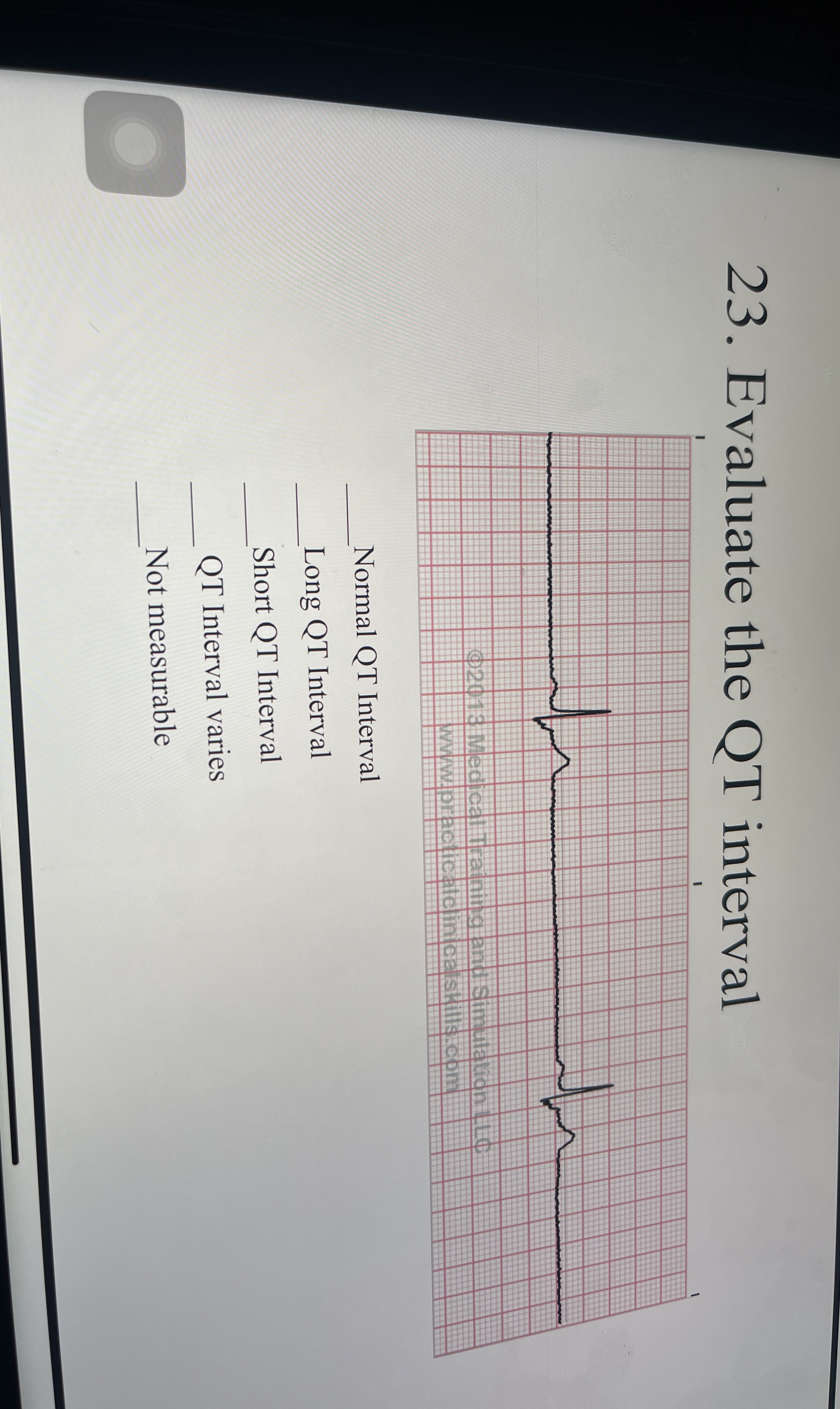 Solved Evaluate the QT interval q,Normal QT Interval q,Long | Chegg.com