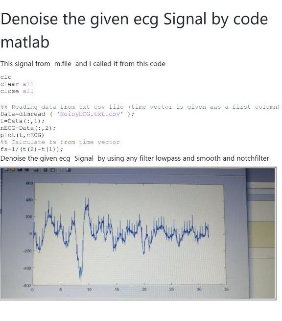 Denoise the given ecg Signal by code matlab This | Chegg.com