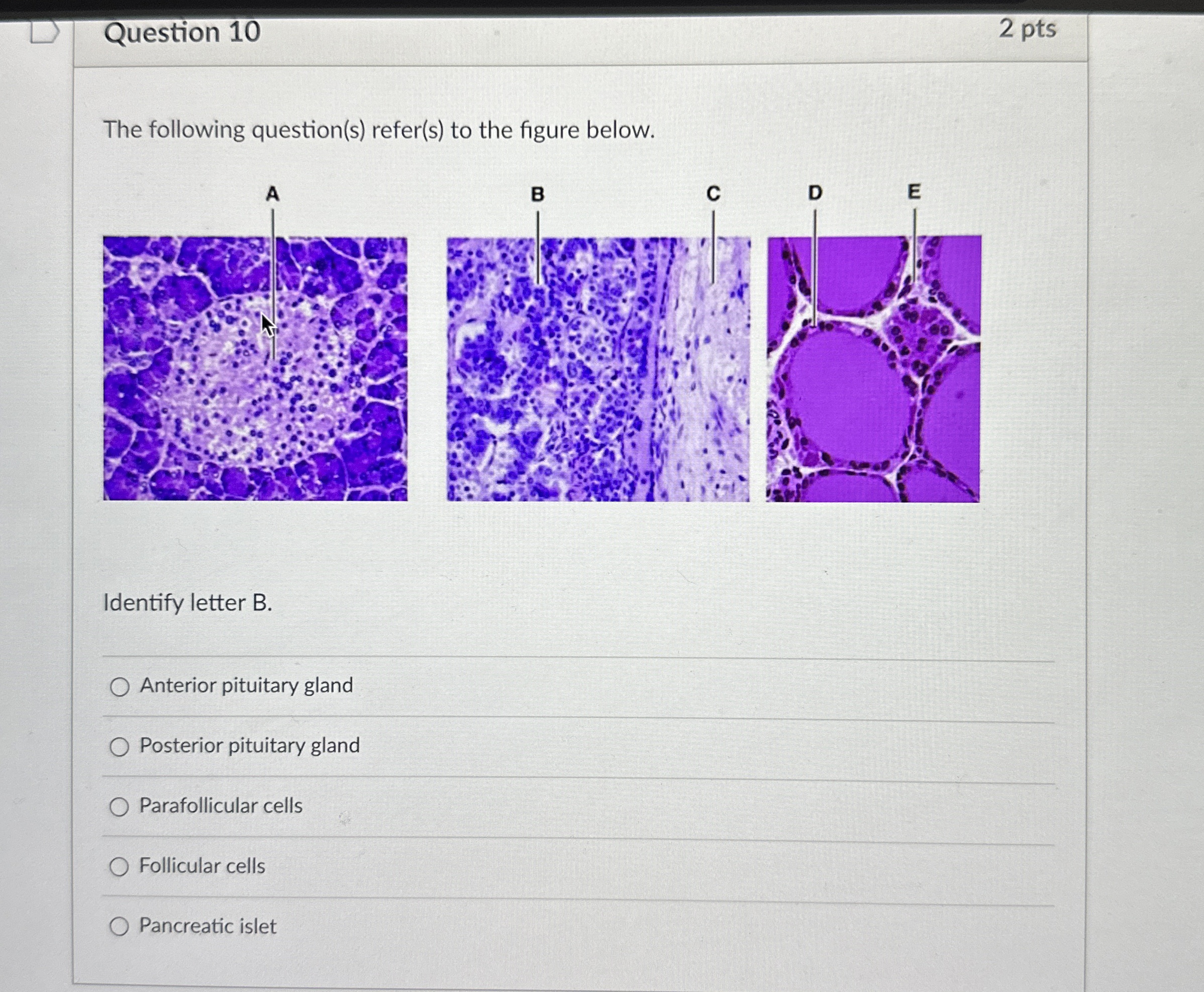 Solved Question 102 ptsThe following question(s) refer(s) | Chegg.com Solved Question 102 ptsThe following question(s) refer(s) | Chegg.com