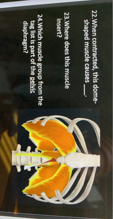 Solved 1. What is the name of the yellow highlighted muscle? | Chegg.com