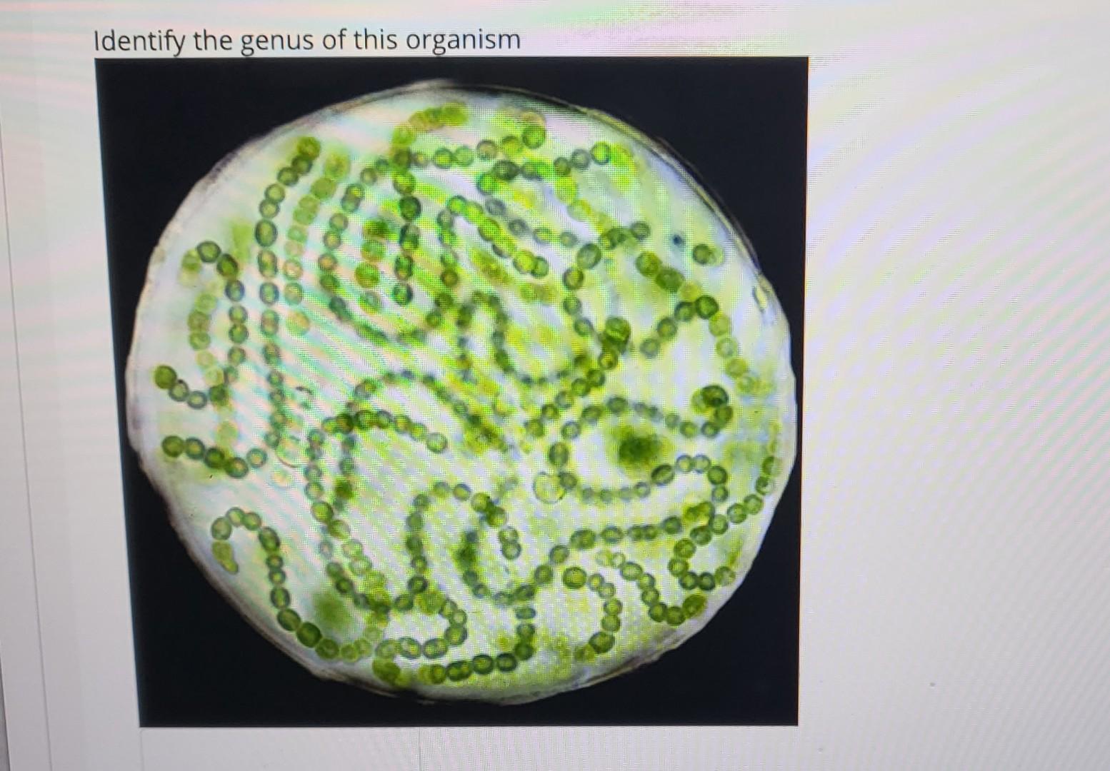 Solved Identify the shape of this cell Identify the genus | Chegg.com