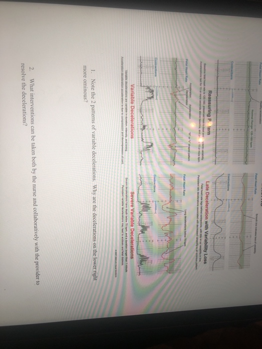 Solved Fetal Monitor Patterns Near Cocos Reassuring Pattern | Chegg.com