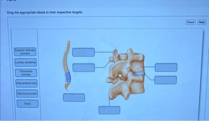 Solved Which part of a vertebra is known as the centrum? | Chegg.com