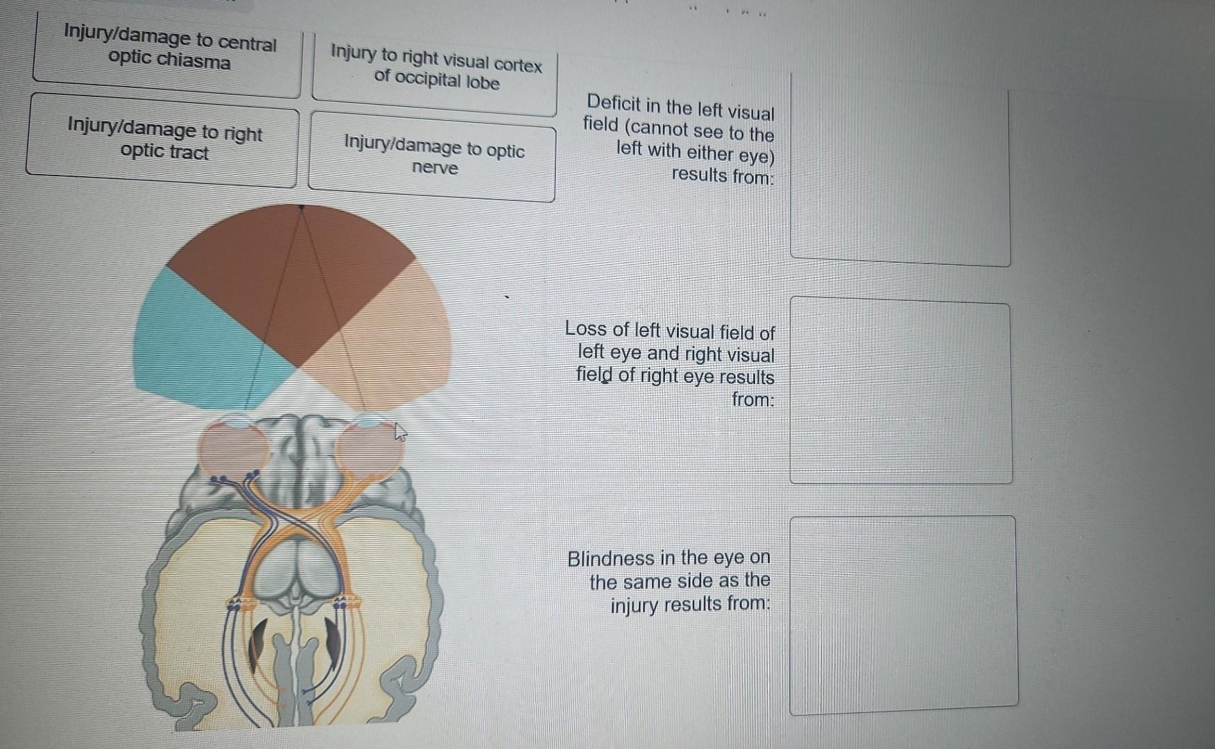 Solved For each visual deficit, determine the type(s) of | Chegg.com