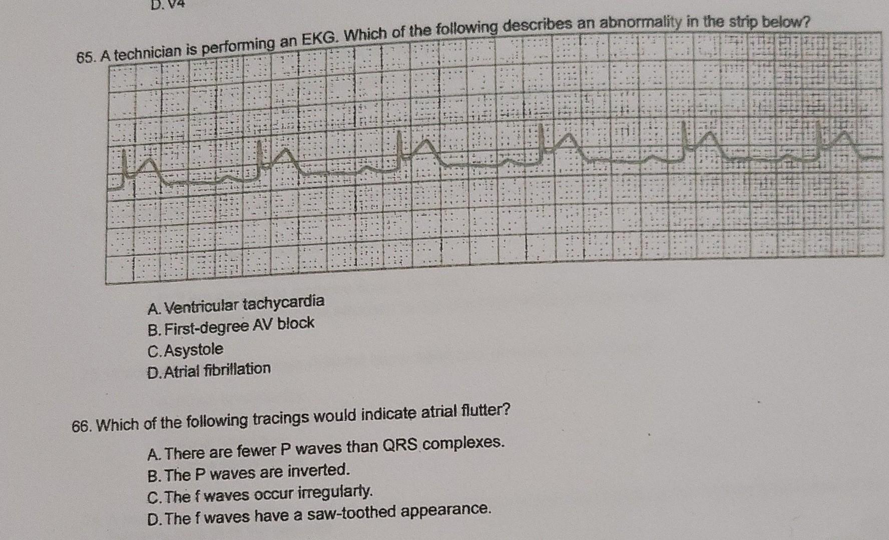 Solved EKG 63. Continuous cardiac monitoring typically uses | Chegg.com