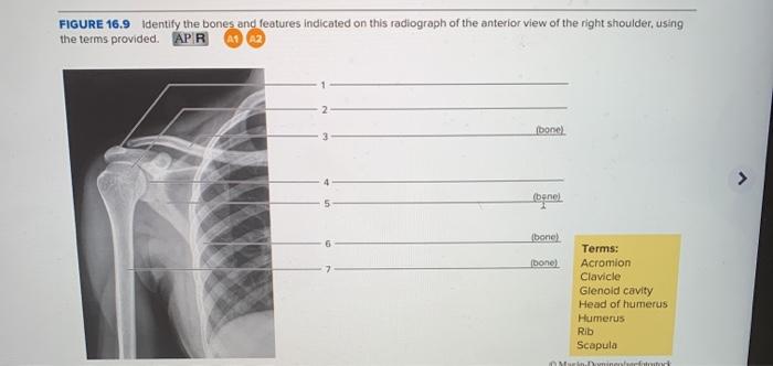 Solved PART D: Assessments Identify the bones and features | Chegg.com