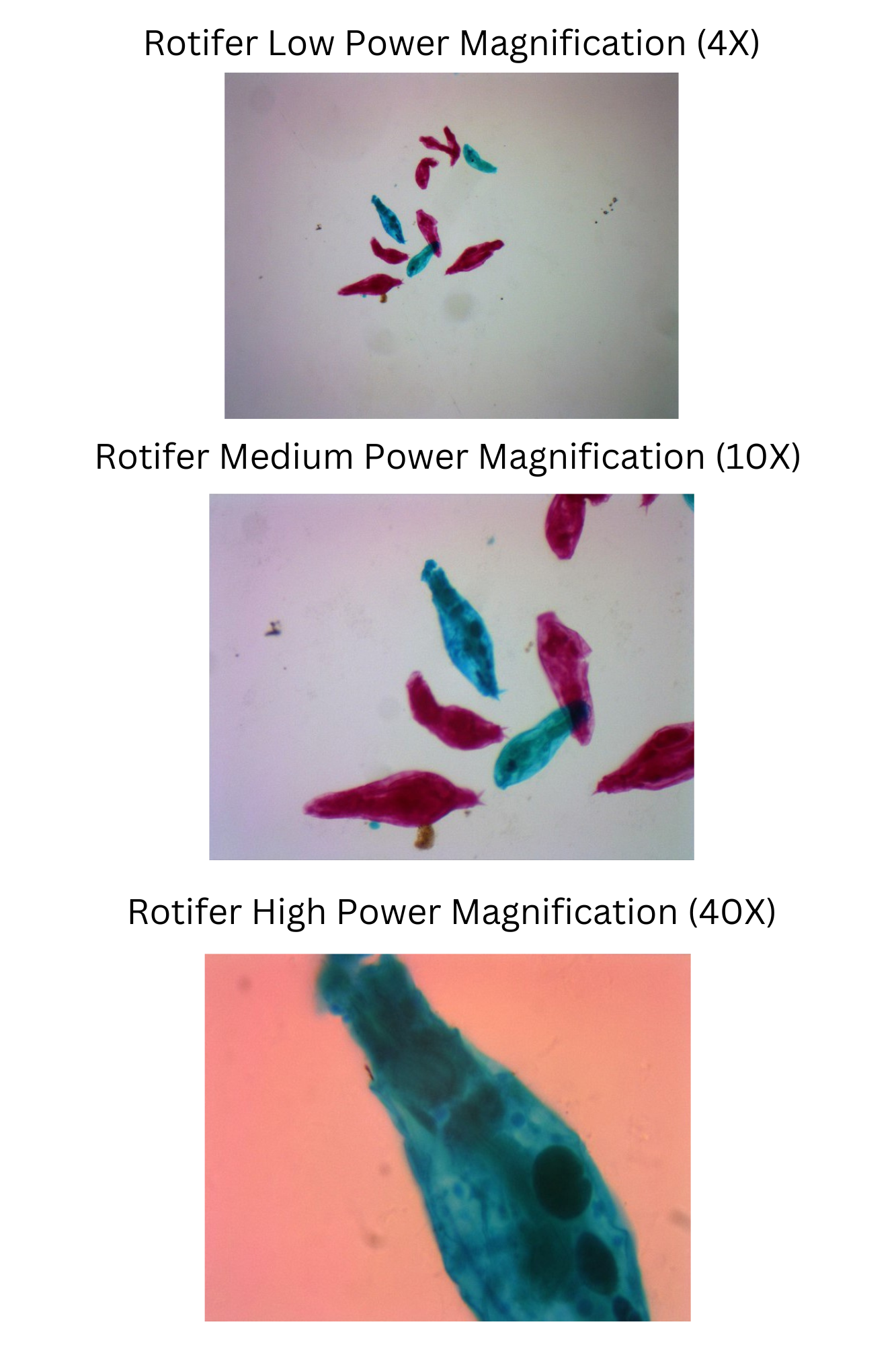 Solved Attached is a Rotifer slide under the microscope at | Chegg.com