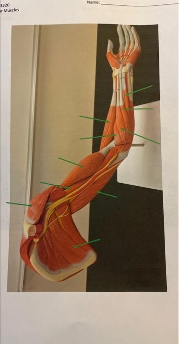 Solved Labeling Appendicular Muscles | Chegg.com