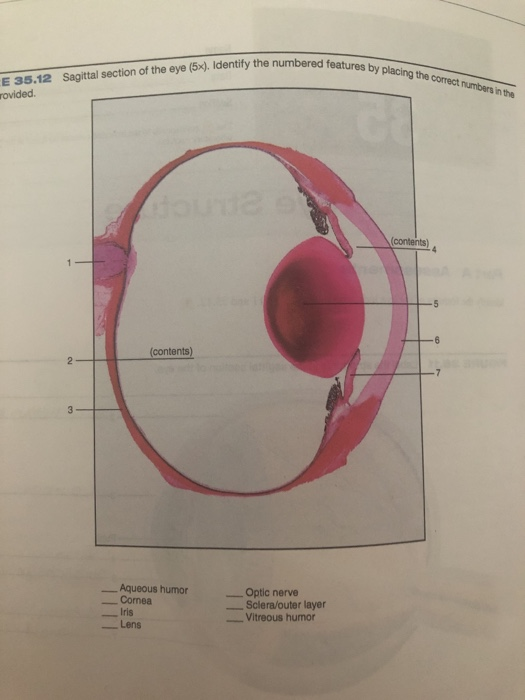 Solved E 35.12 Sagittal section of the eye (5x). Identify | Chegg.com Solved E 35.12 Sagittal section of the eye (5x). Identify | Chegg.com