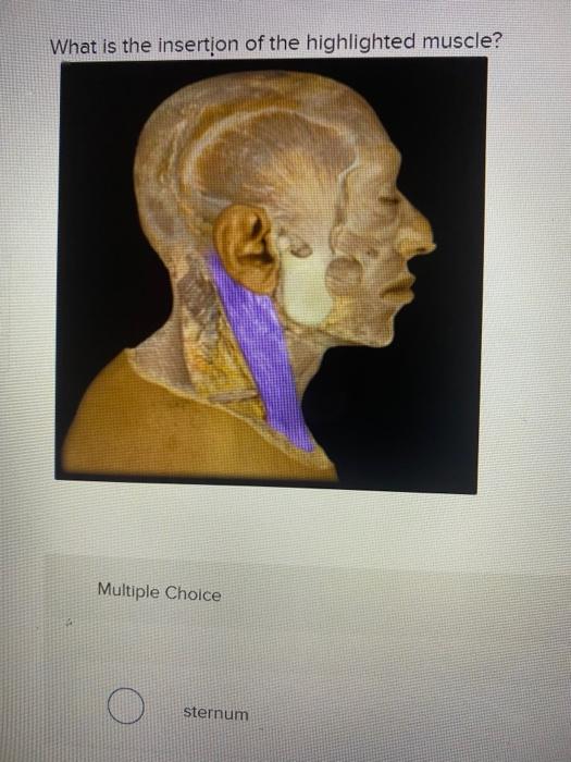 Solved What is the insertion of the highlighted muscle? | Chegg.com