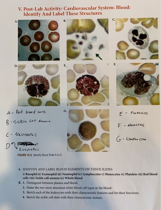 Solved V. Post-Lab Activity: Cardiovascular System: Blood: | Chegg.com