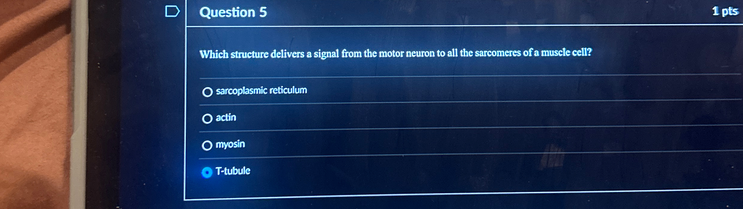 Solved Question 51 ﻿ptsWhich structure delivers a signal | Chegg.com