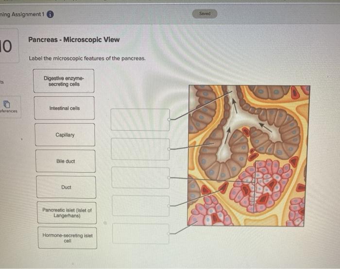 Solved ning Assignment 10 Saved Pancreas - Microscopic View | Chegg.com Solved ning Assignment 10 Saved Pancreas - Microscopic View | Chegg.com