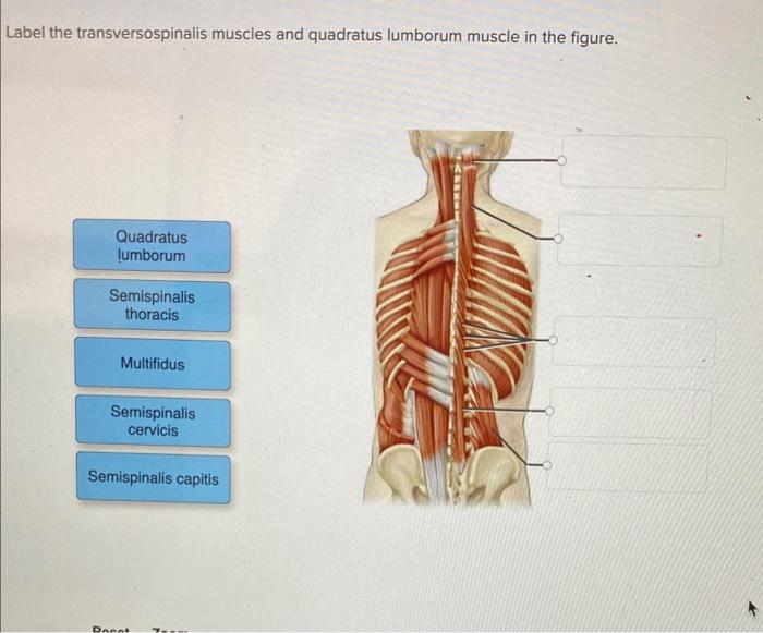 Classify the muscles of the anterior neck as either | Chegg.com