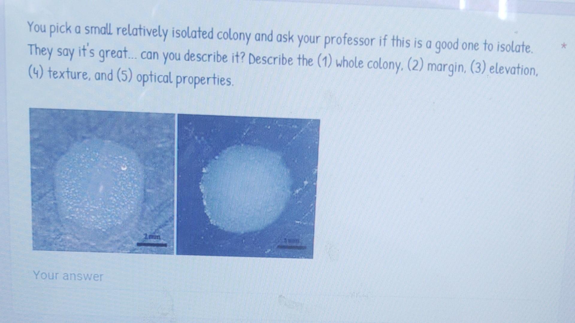 You pick a small relatively isolated colony and ask | Chegg.com