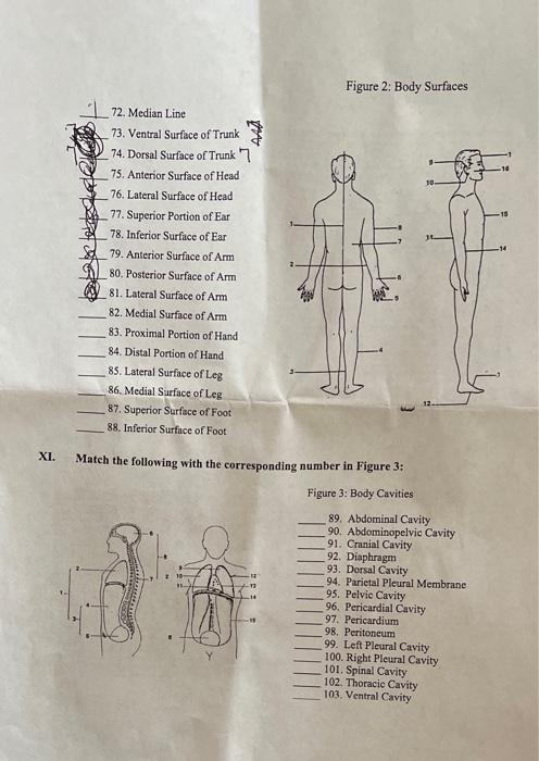 Solved Figure 2: Body Surfaces 72. Median Line 73. Ventral | Chegg.com