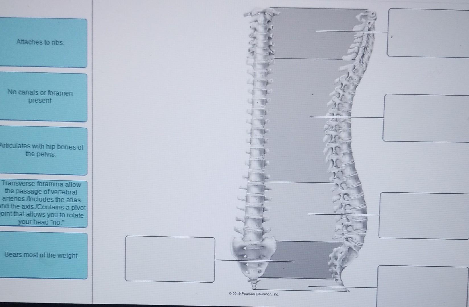 Solved Attaches to ribs. No canals or foramen present | Chegg.com