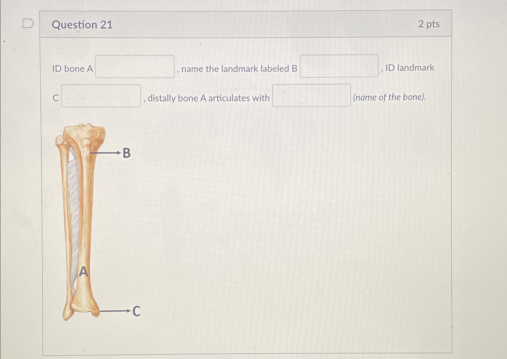 Solved Question 212 ﻿ptsID bone A , ﻿name the landmark | Chegg.com
