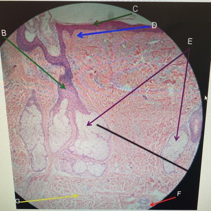 Solved Discuss08_wk11 Histology03 V Overview: In this | Chegg.com