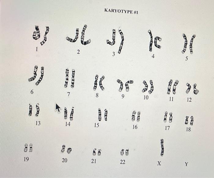 Solved 6. Examine the following karyotypes and answer the | Chegg.com