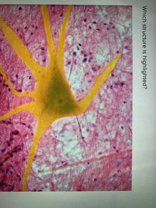 Solved Which structure is highlighted? bipolar neuron | Chegg.com