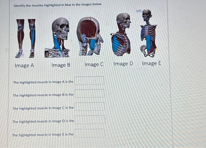 Solved Identify the muscles highlighted in blue in the | Chegg.com