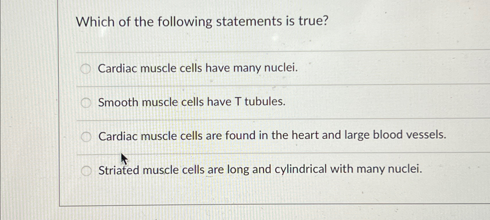 Solved Which of the following statements is true?Cardiac | Chegg.com