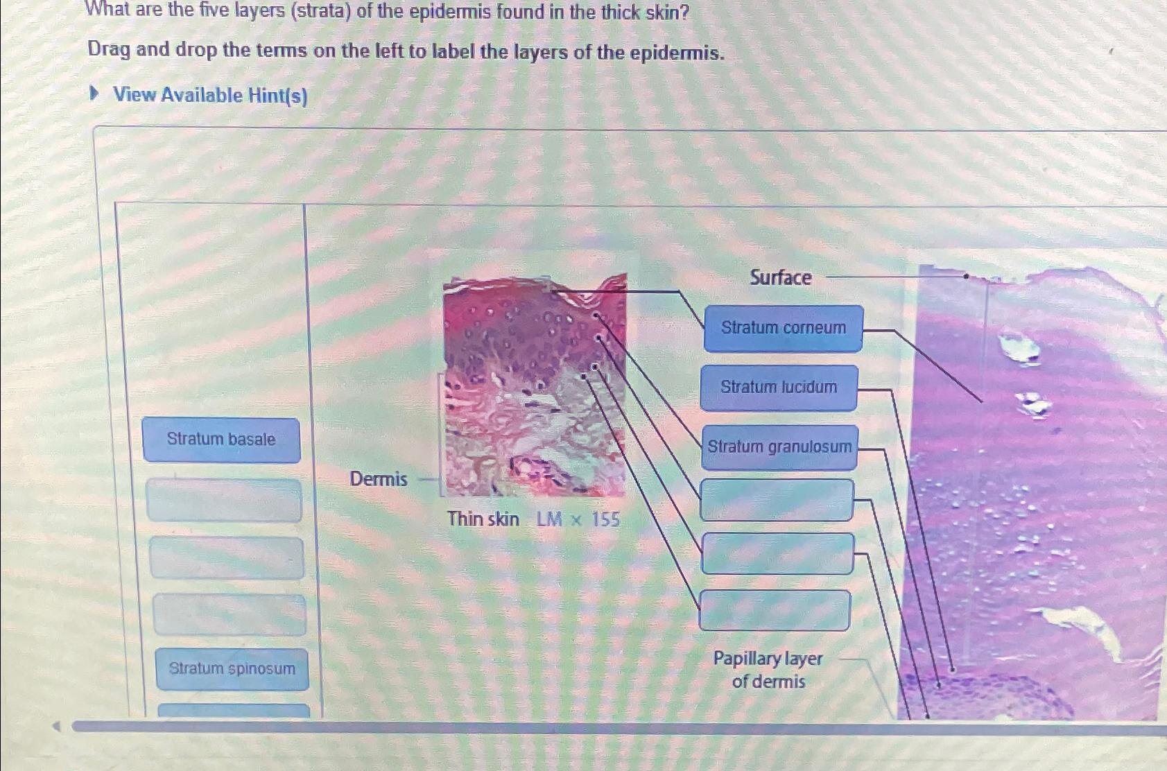 Solved What are the five layers (strata) ﻿of the epidermis | Chegg.com