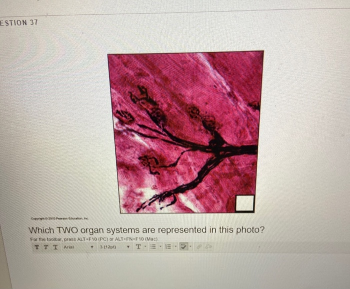 Solved This is a muscle cell. What are the "stringy things" | Chegg.com