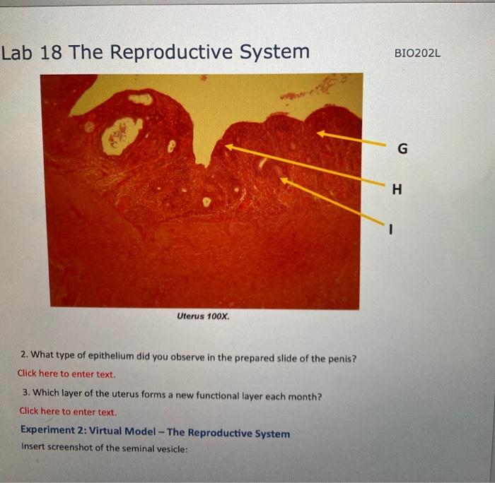 Solved Lab 18 The Reproductive System BIO202L G H 1 Uterus | Chegg.com