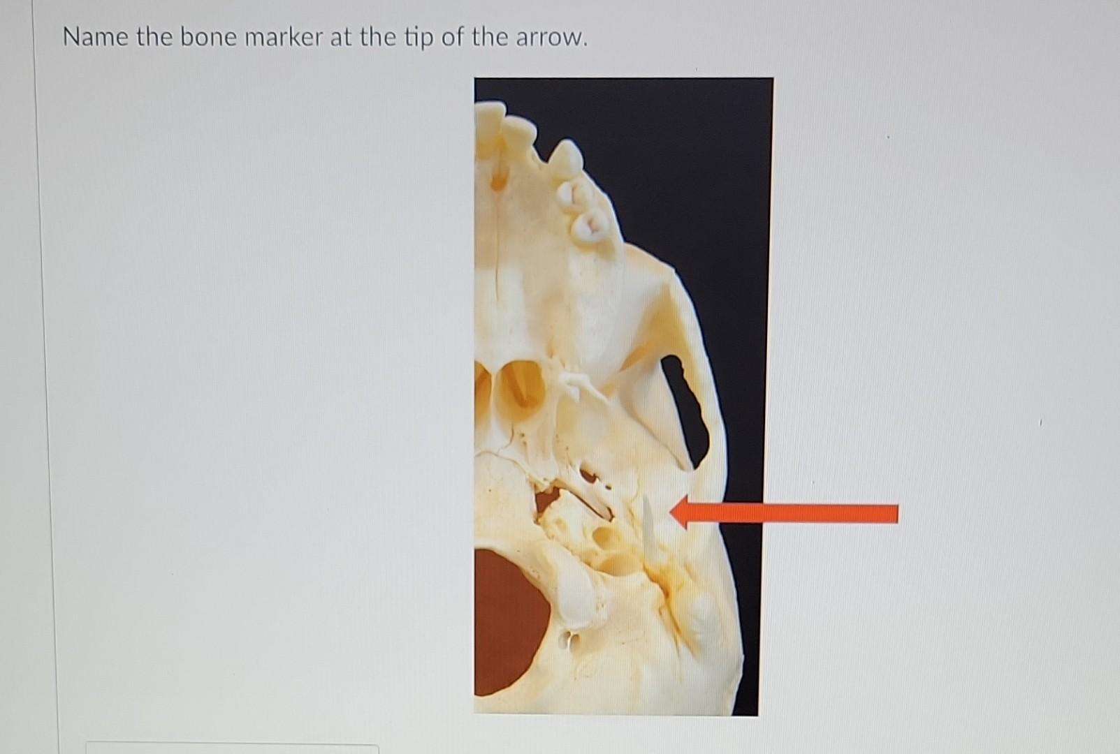 Solved Name the bone marker at the tip of the arrow. Name | Chegg.com