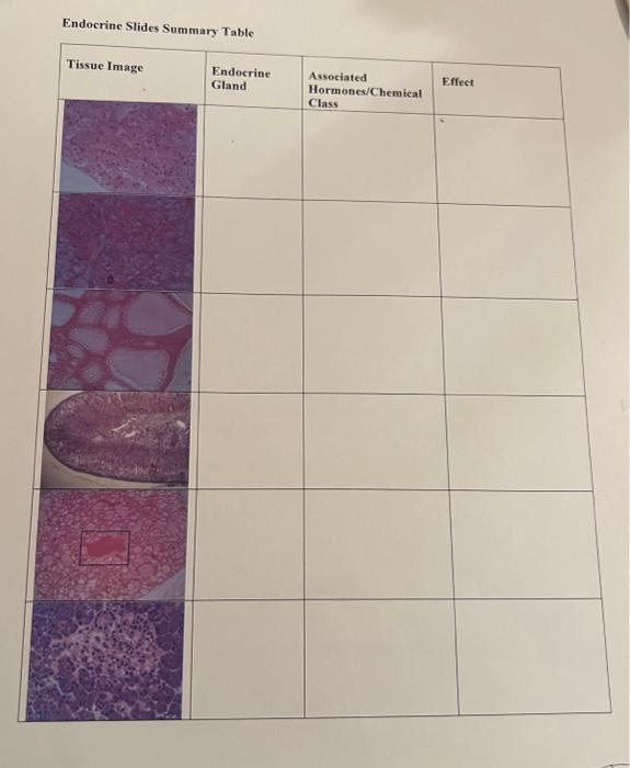 Solved Endocrine Slides Summary Table | Chegg.com