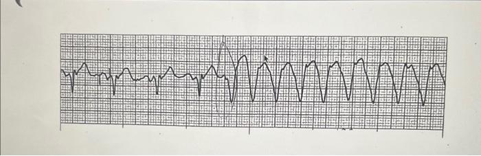 Solved 1 .ventricular Rate /Rhythm---- Atrial Rate / | Chegg.com